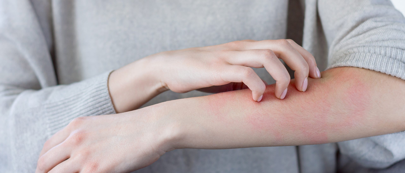 Skin Diseases - Ayur Treat